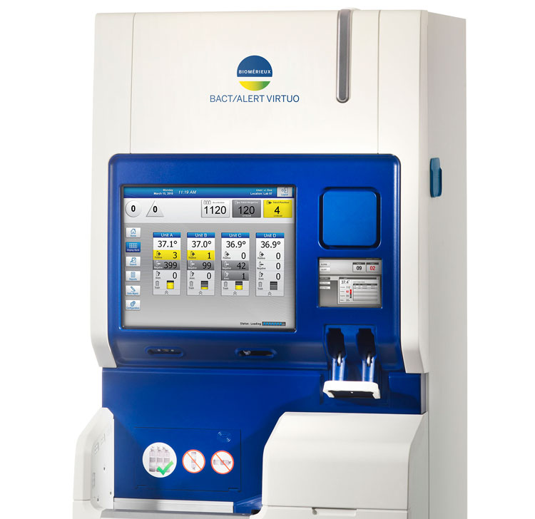 FV applied VIRTUO system in diagnostic test
