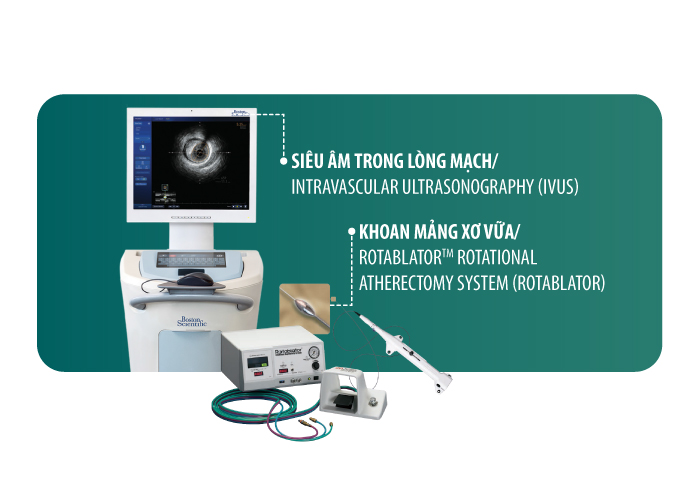 FV Applies Intravascular Ultrasound (IVUS) And Rotablator In ...