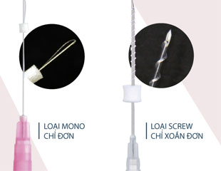 Safe, effective weight loss with thread embedding acupuncture therapy