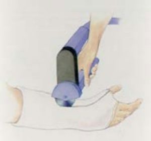 Care of Casts and Splints - FV Magazine