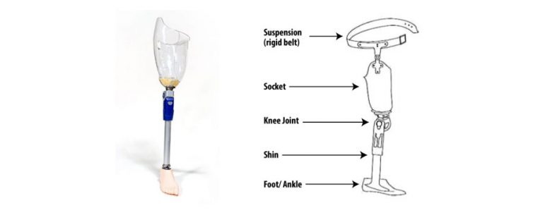 Rehabilitation for Lower Limb Amputees - FV Magazine