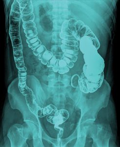 Barium Study - FV Magazine