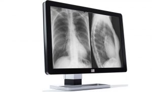 General Radiography (X-ray) - FV Magazine