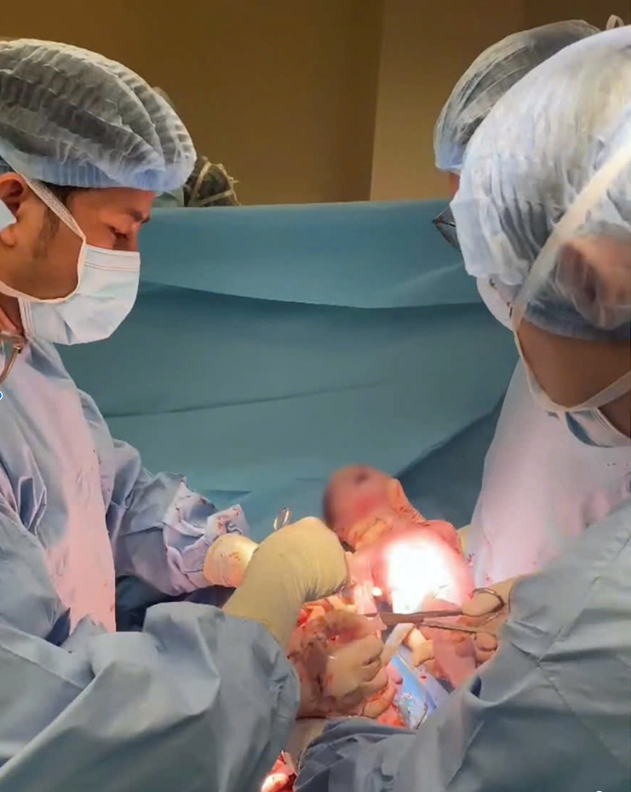 BABY WRAPPED IN 8 KG FIBROID BORN HEALTHY AT FV HOSPITAL - FV Magazine